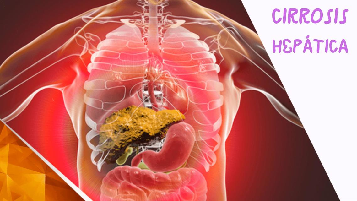 Cirrosis hepática | MARYURI LISBETH | uDocz