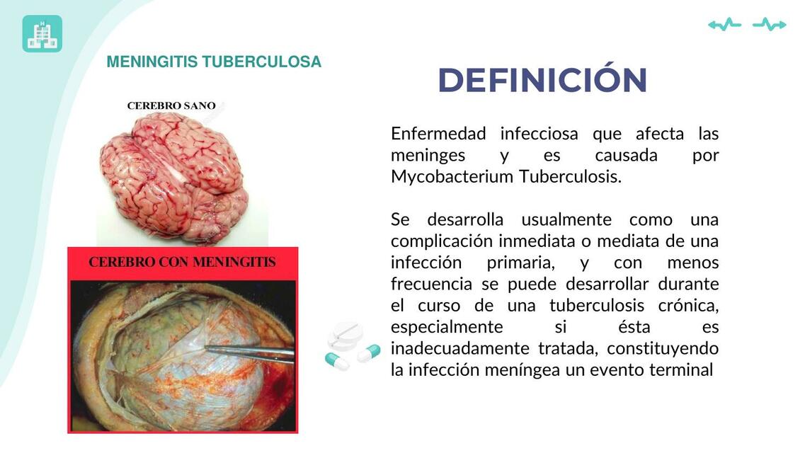 Meningitis tuberculosa | MARYURI LISBETH | uDocz
