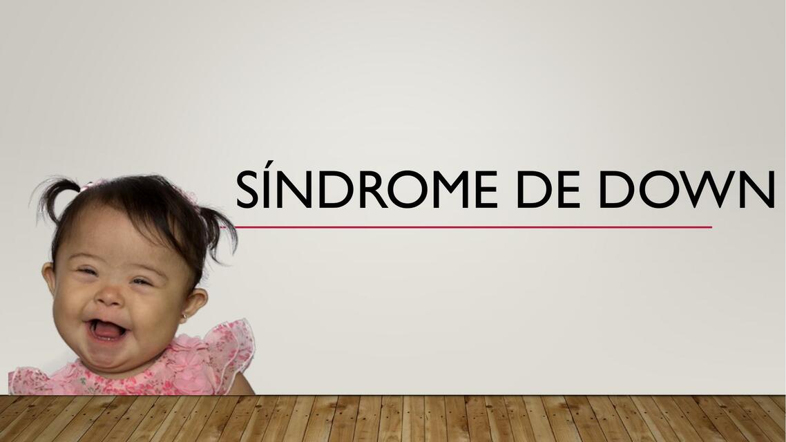 Síndrome de Down | JPaul HAsto | uDocz