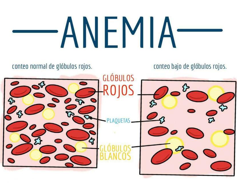 Anemia | fraii | uDocz