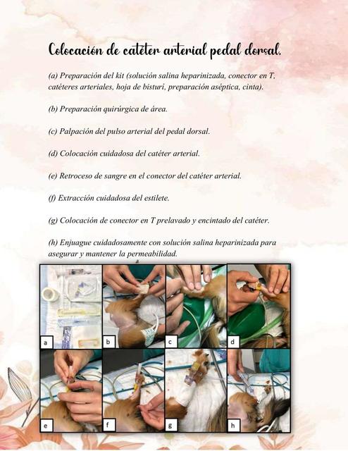 Colocación de catéter arterial pedal dorsal | fraii | uDocz