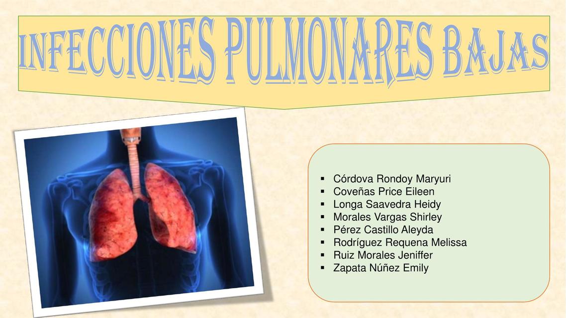 Infecciones Respiratorias Bajas Maryuri Lisbeth Udocz