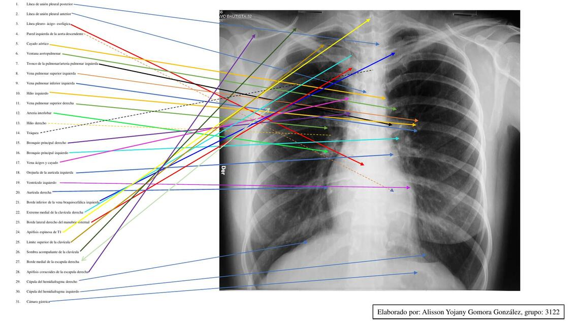 Partes de una radiografía de torax | Alisson Gomora Gonzalez | uDocz