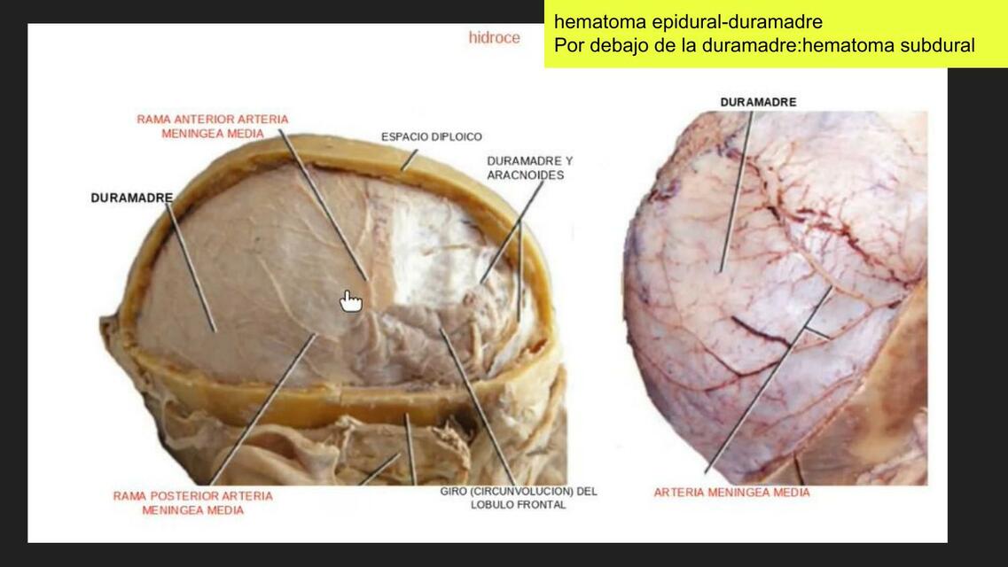 Arteria y Duramadre- Anatomía | Bosque | uDocz