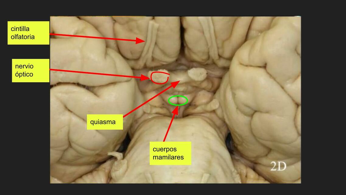 Nervio óptico y cuerpos mamilares | Bosque | uDocz