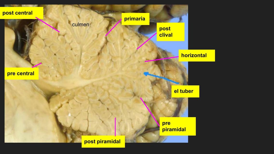 Cerebelo | Bosque | uDocz