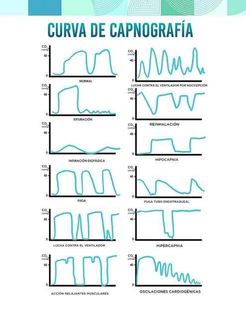 Curva de capnografia | fraii | uDocz