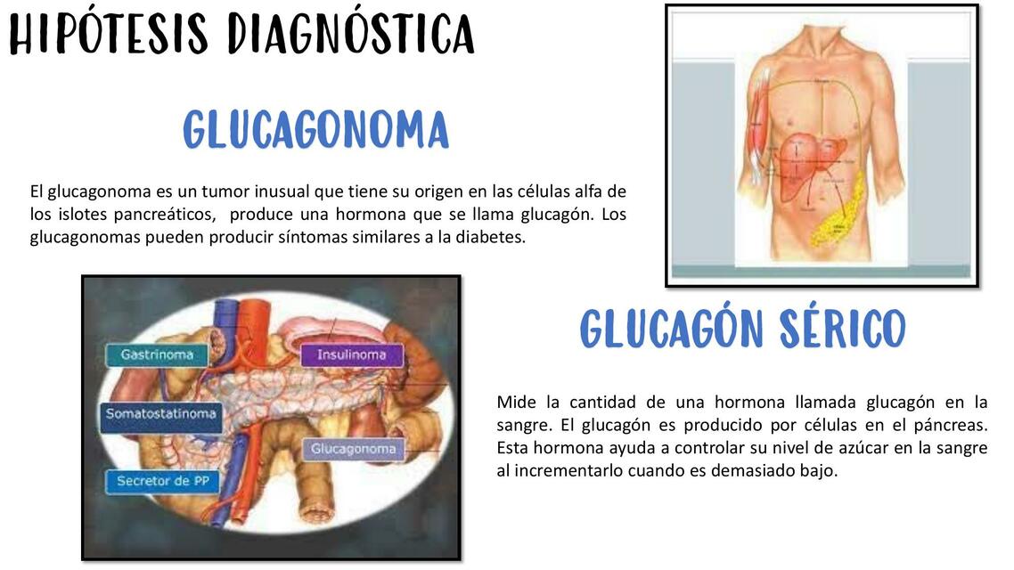 Práctica caso 10 glucagonoma | MARYURI LISBETH | uDocz