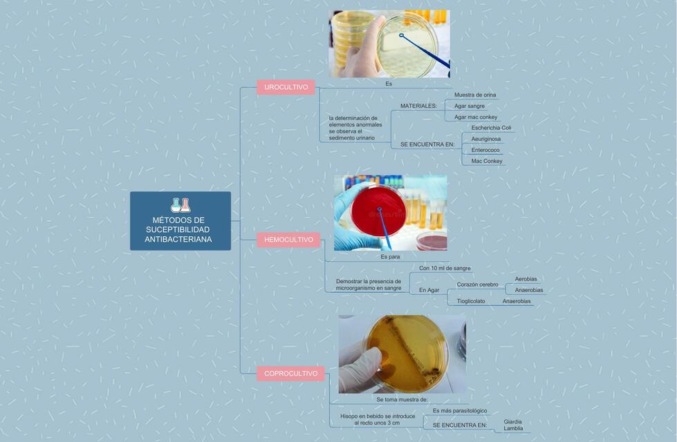 Métodos de susceptibilidad antibacteriana | MARYURI LISBETH | uDocz