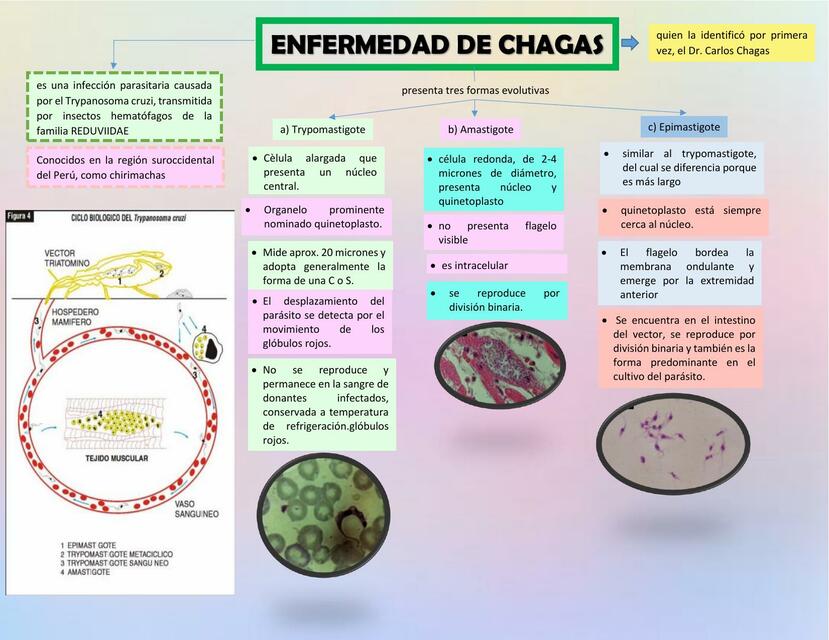 Enfermedad de Chagas | MARYURI LISBETH | uDocz