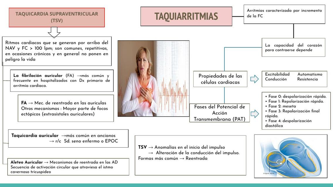 Taquicardia Supraclavicular en el Anciano | MiddleMedic | uDocz