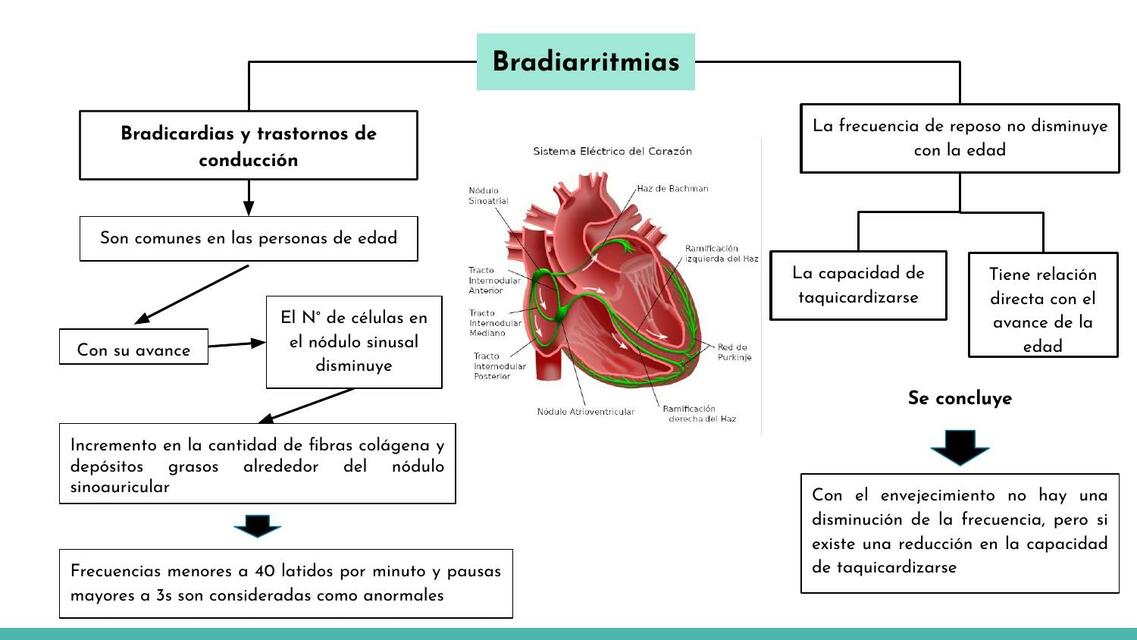 Bradiarritmias en el Anciano | MiddleMedic | uDocz