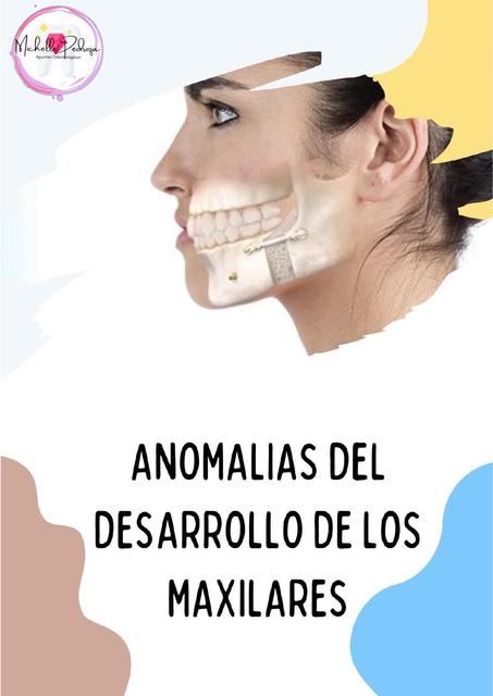Anomalías del desarrollo de los maxilares | Michelle Pedroza | uDocz Anomalías del desarrollo de los maxilares | Michelle Pedroza | uDocz