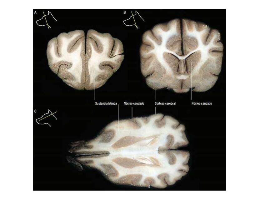 Secciones transversales (A y B) y dorsal (C) del cerebro canino | fraii ...