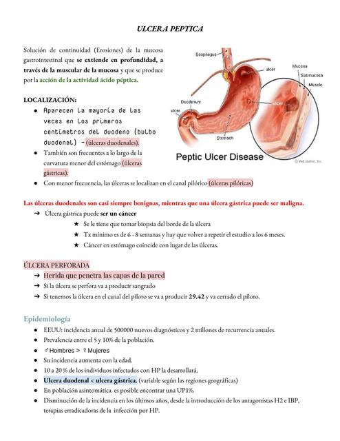 Ulcera péptica | MEDilove | uDocz