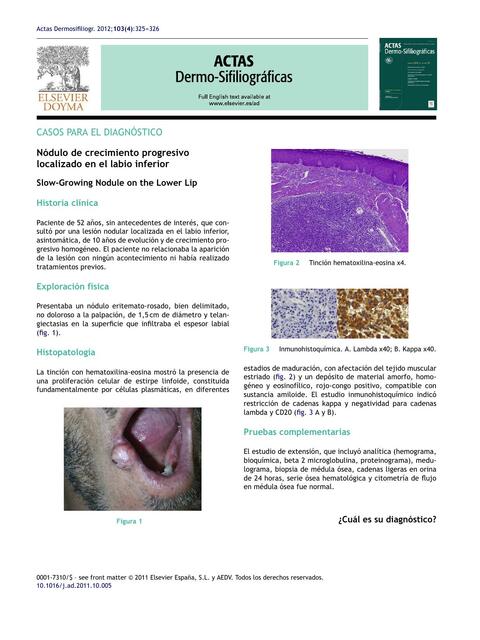 Nódulo labial | Busca y descarga apuntes gratis | uDocz