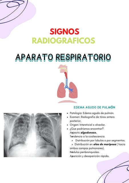 CAUSAS DEL EDEMA PULMONAR | MARYURI LISBETH | uDocz