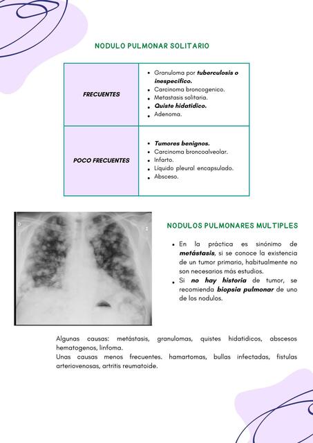Signo radiológico: Nódulo pulmonar solitario | MARYURI LISBETH | uDocz