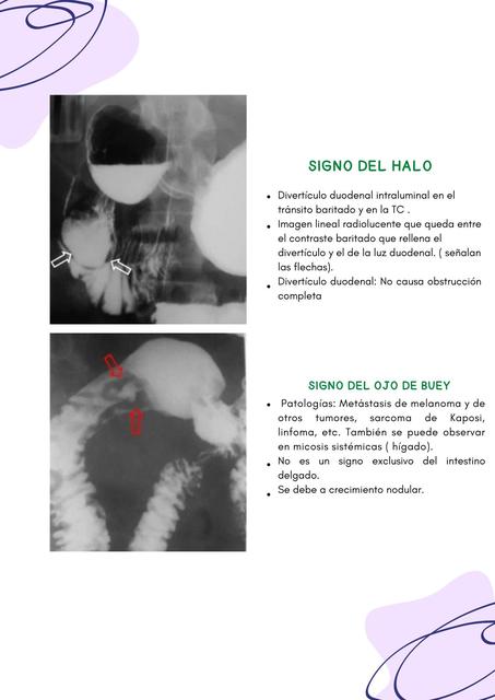 Resúmenes de Signo de ojo buey | Descarga apuntes de Signo de ojo buey