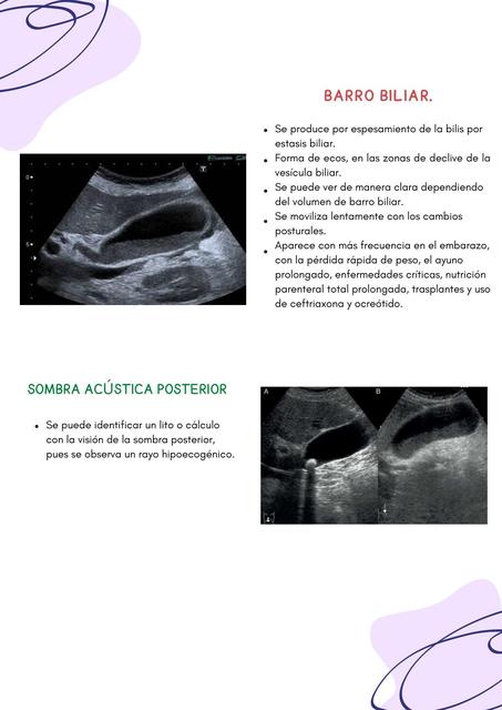 Resúmenes de Barro biliar | Descarga apuntes de Barro biliar