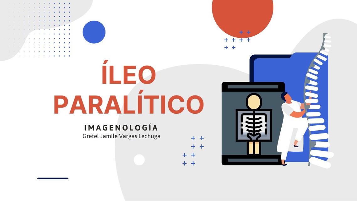 Íleo Paralítico | Gretel Vargas | uDocz