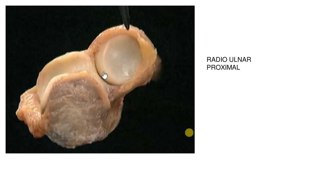 Articulaciones- Anatomía 11 | Bosque | uDocz