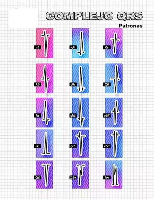 Complejo QRS patrones | fraii | uDocz