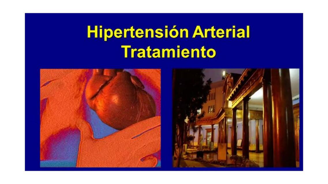 4 Hipertensión Arterial Ii Tratamiento Hta Liquidoh Udocz