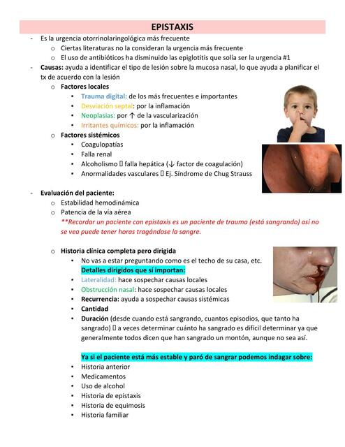 Epistaxis | MEDilove | uDocz