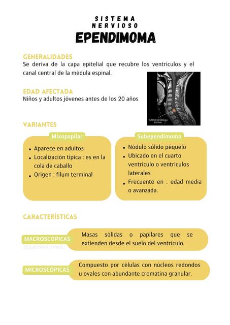 Ependimoma | MARYURI LISBETH | uDocz