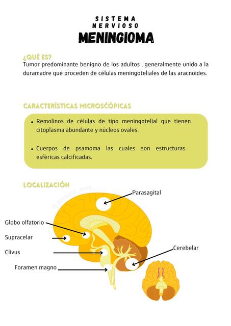Meningioma | MARYURI LISBETH | uDocz