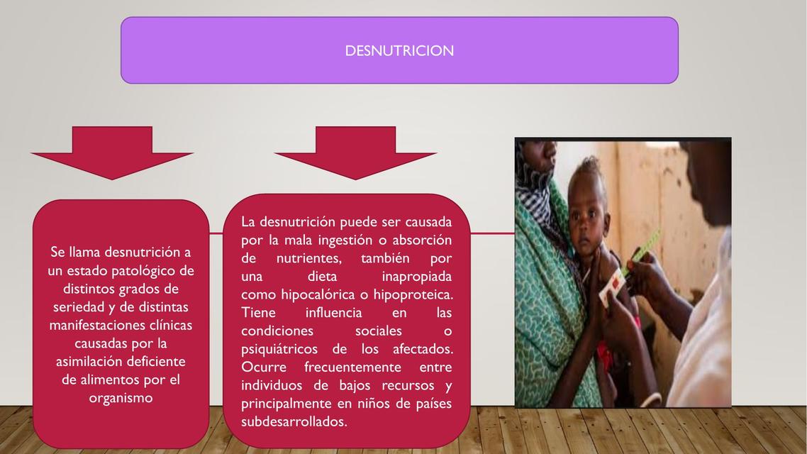 Desnutrición La Escuela Médica Udocz