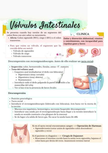 Vólvulos Intestinales | MARYURI LISBETH | uDocz