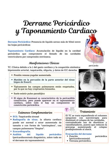 Derrame Pericárdico Y Taponamiento Cardiaco Maryuri Lisbeth Udocz