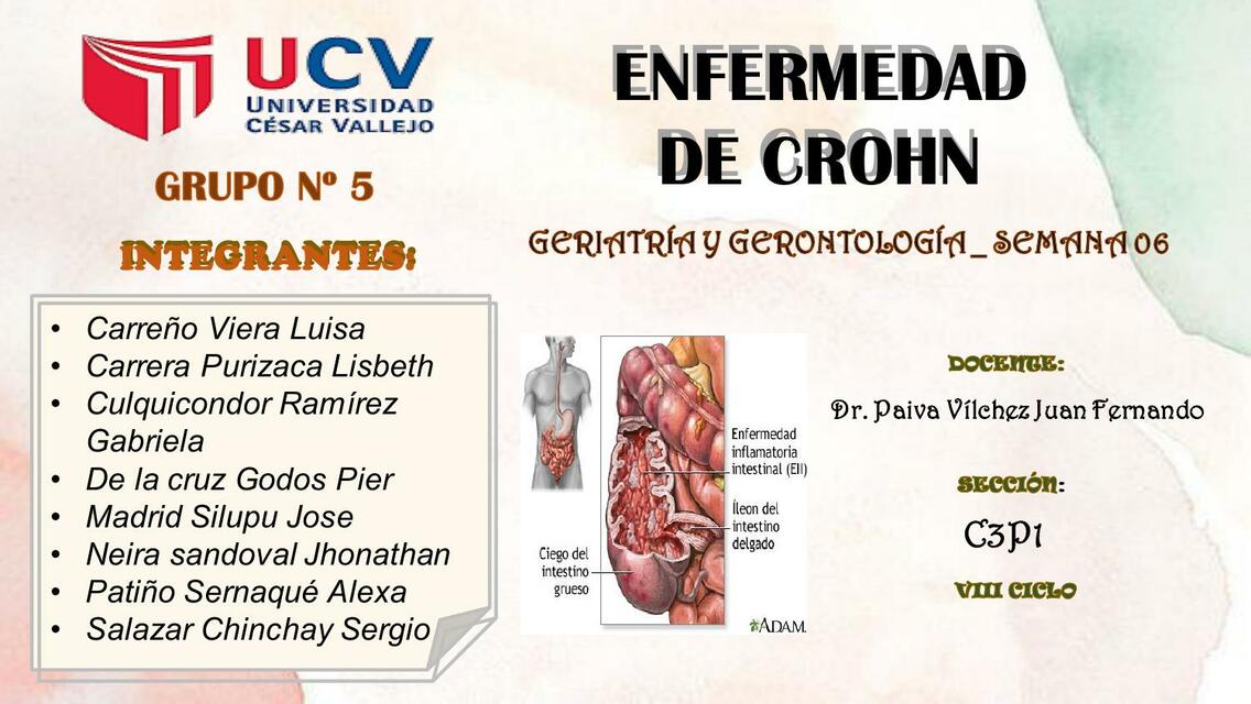 Enfermedad de Crohn | MARYURI LISBETH | uDocz