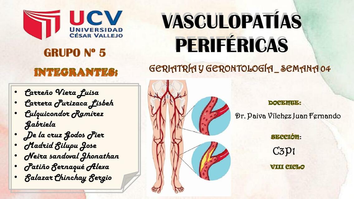 GRUPO 5: Vasculopatías periféricas | MARYURI LISBETH | uDocz