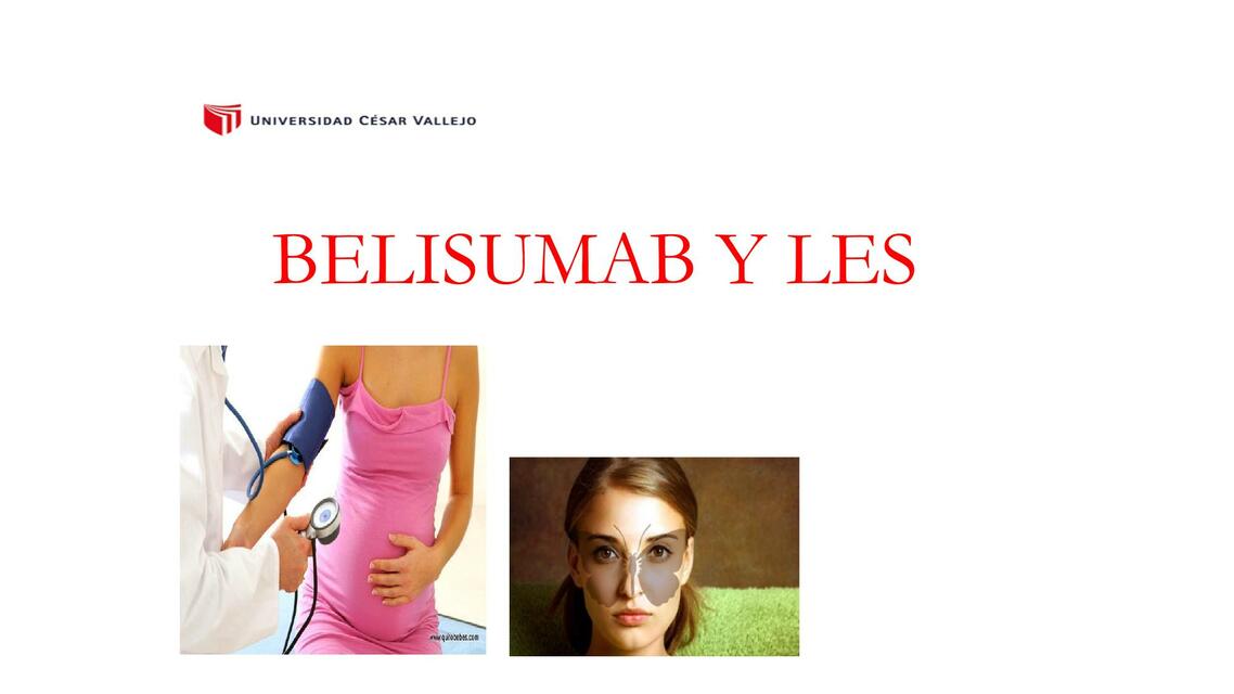 Belisumab y LES | MARYURI LISBETH | uDocz