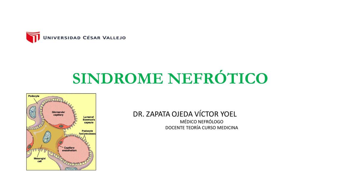 Sindrome nefrótico | MARYURI LISBETH | uDocz