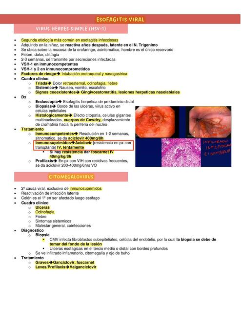 Esofagitis viral | uDocz
