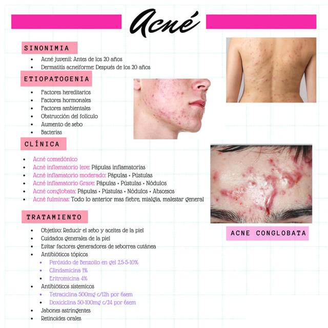 Acné | MARYURI LISBETH | uDocz