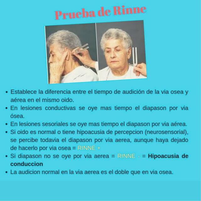 Prueba de rinne | MARYURI LISBETH | uDocz
