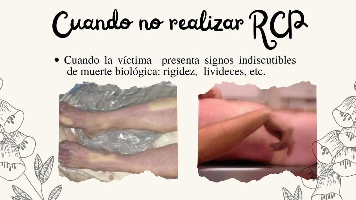 Cuando no realizar un RCP | Linda Milena León Gómez | uDocz