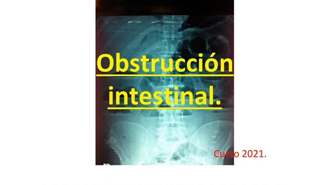 Obstrucción intestinal | uDocz