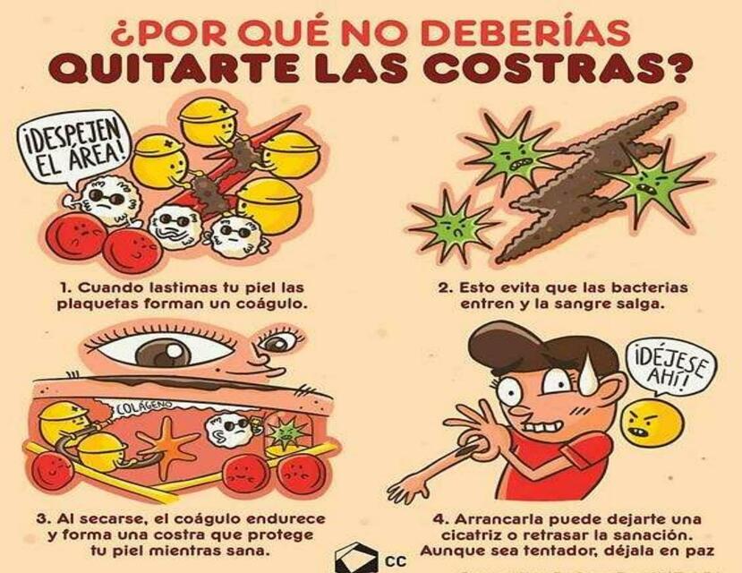 No debes quitarte las costras | fraii | uDocz