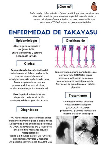 Enfermedad De Takayasu Maryuri Lisbeth Udocz