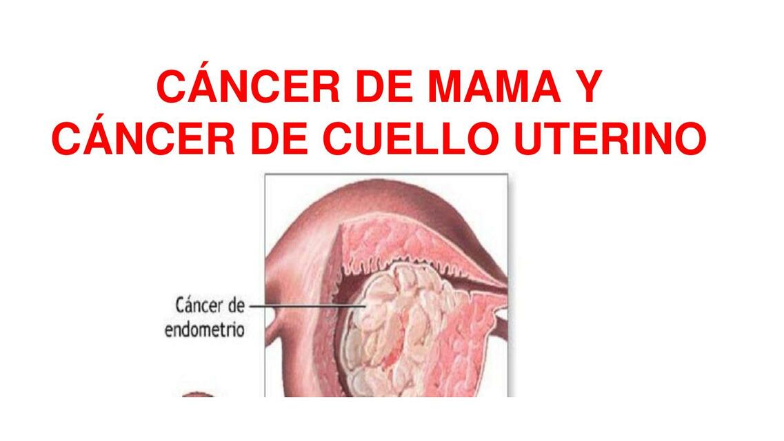 Cáncer de Mama y Cuello Uterino | MARYURI LISBETH | uDocz