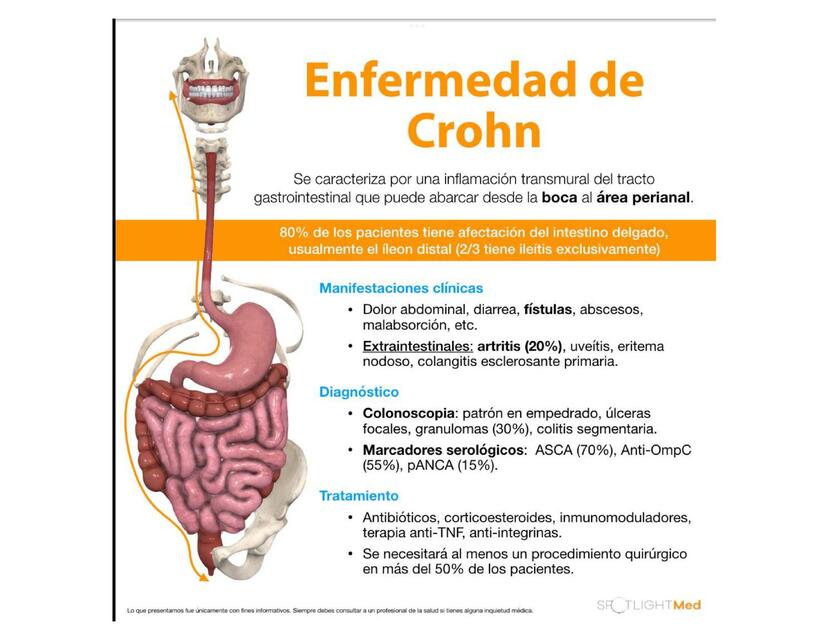Enfermedad de Crohn | uDocz