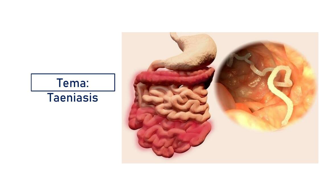 Taeniasis | Tiroxina Med | uDocz