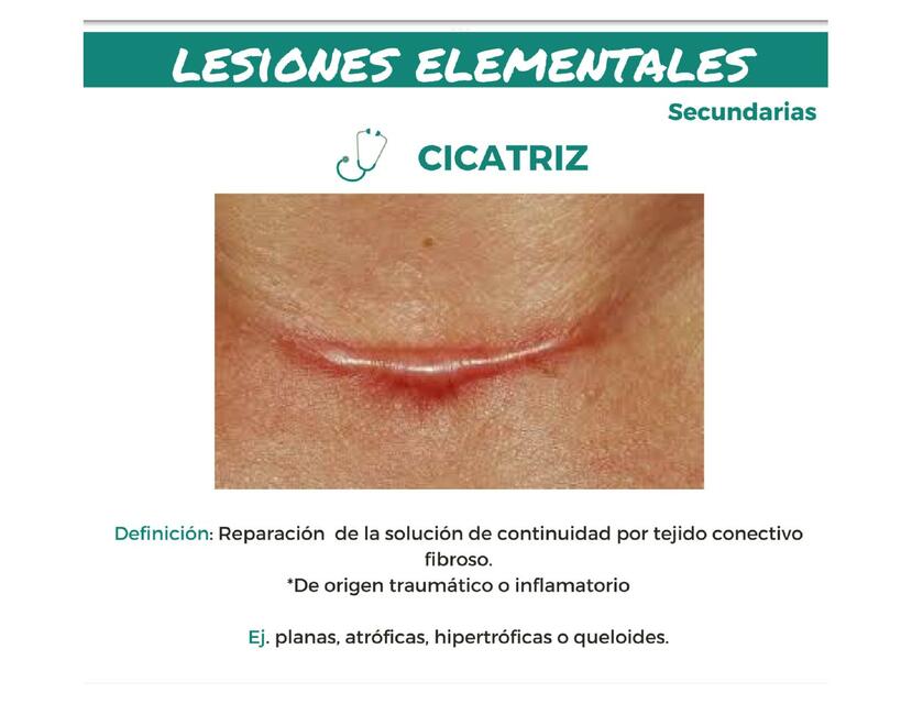 Cicatriz | uDocz