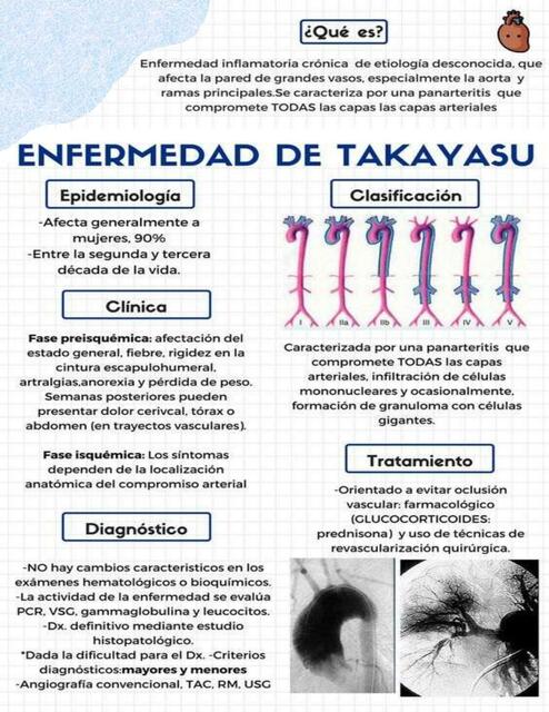 Clasificación De La Arteritis De Takayasu